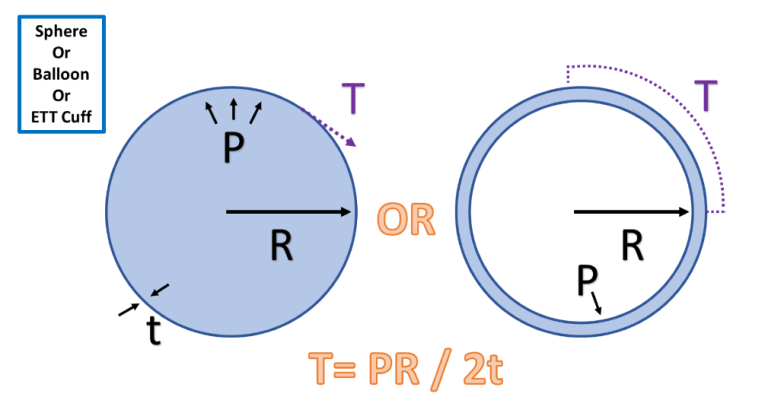 Laplace's Law - Its applications in critical care and peri-operative ...